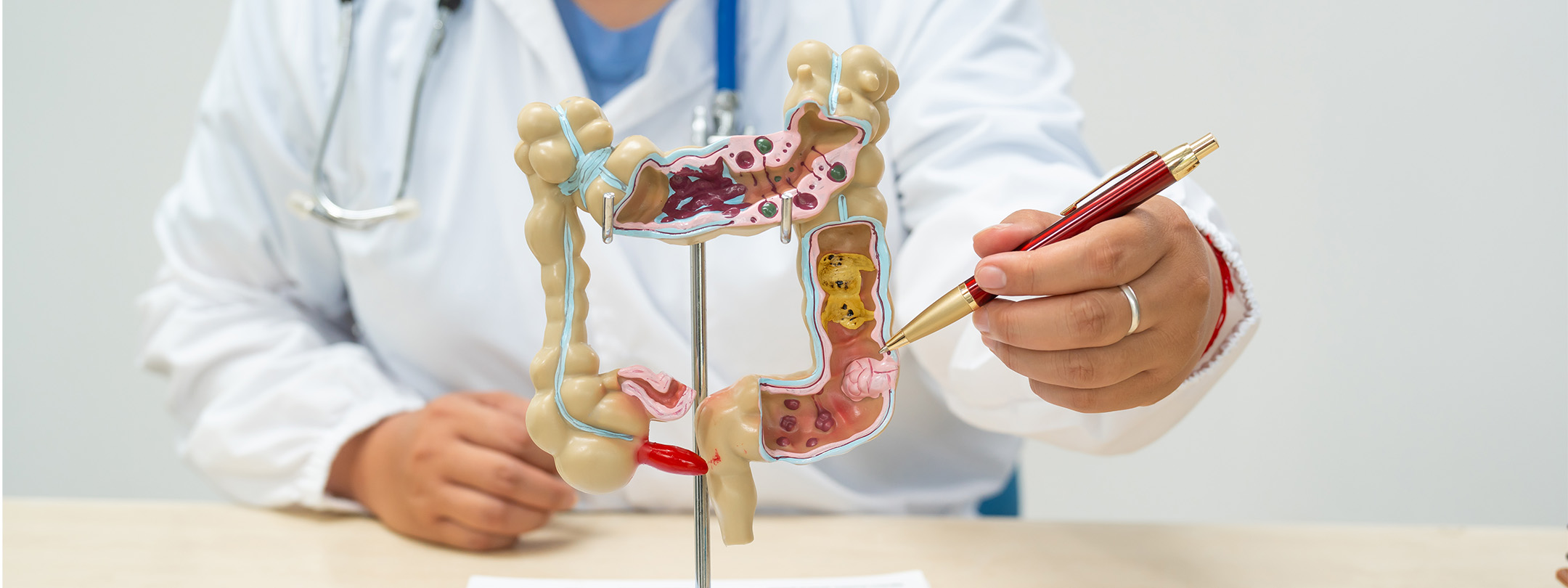 Guidelines for Colorectal Cancer Screening | Select Health